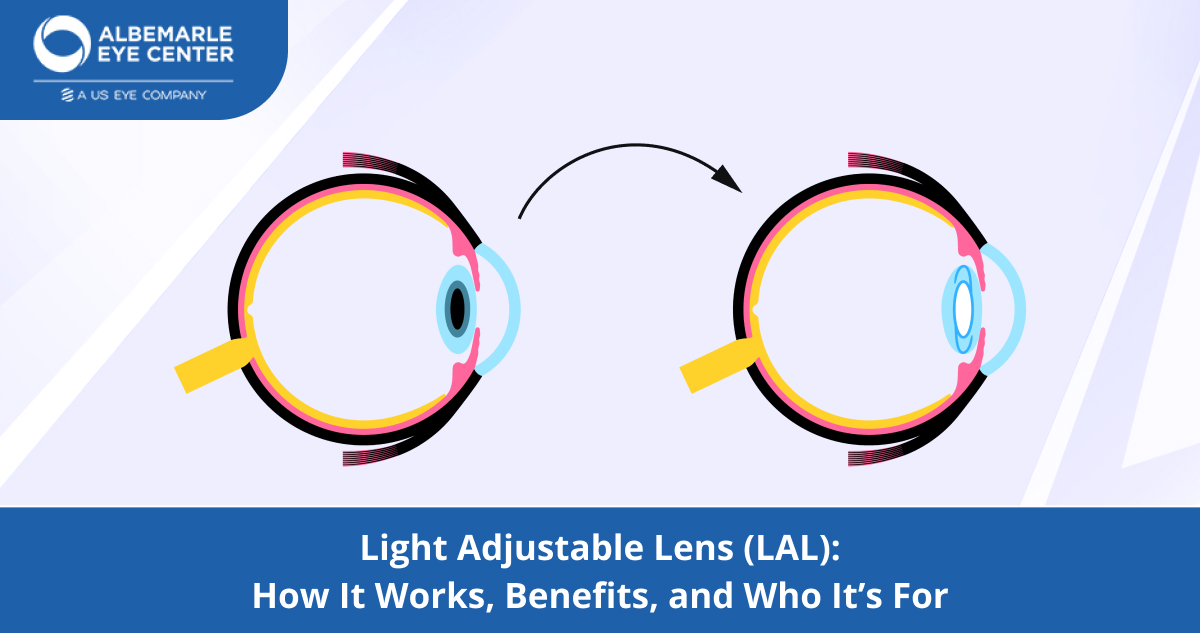 Light Adjustable Lens (LAL) | Advanced Cataract Surgery Option